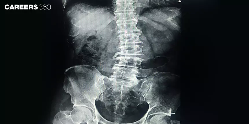 Discovery Of X Ray: An Accidental Discovery That Changed The World