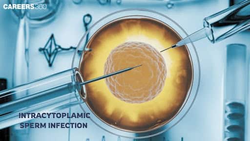 Intracytoplasmic Sperm Injection