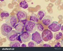 CML Full Form - What is the Full Form of CML?